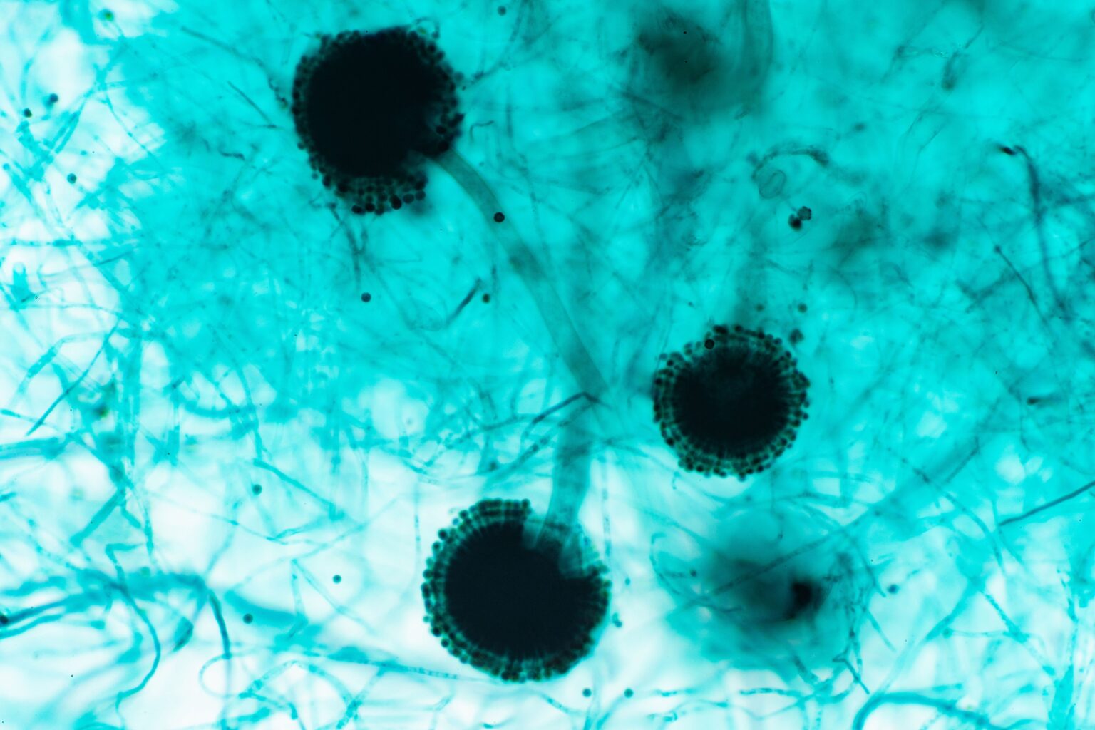 Understanding Mycotoxin Testing: What It Is, Who Needs It, and How ...